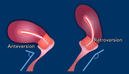 MR Adult Female Pelvis for Cervical Cancer Staging W/WO BODY Protocol | OHSU